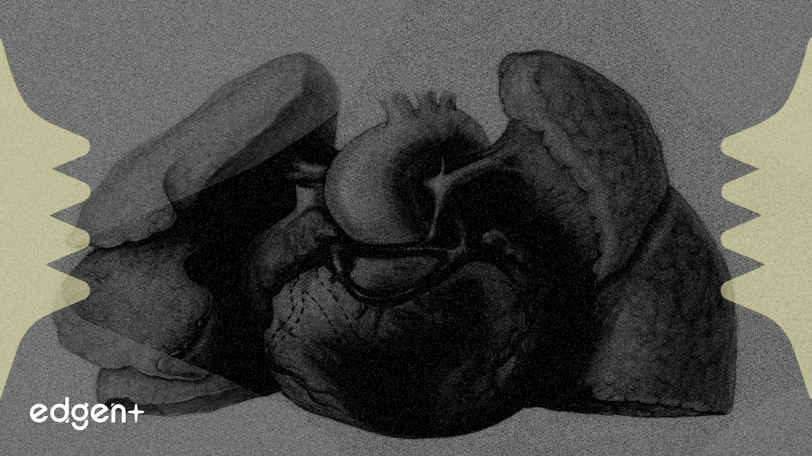 Edwards Lifesciences Obtiene Aprobación de la FDA para Válvula Cardíaca ...